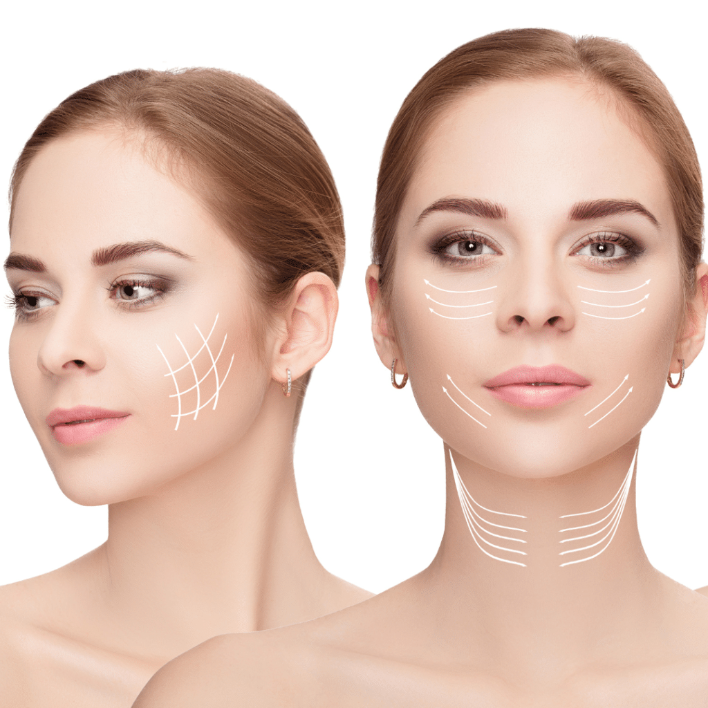 Endolift à Lille : Lifting endoscopique | Clinic R.